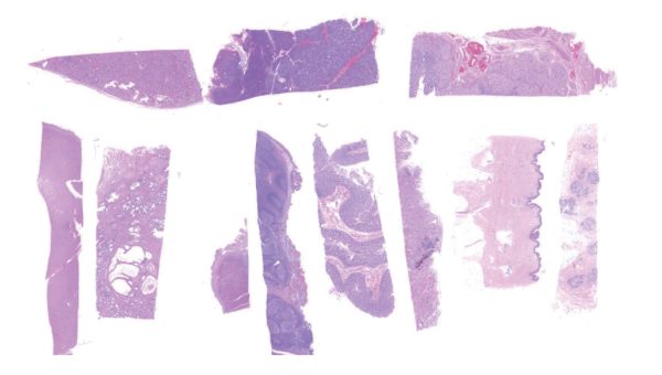 High RNA Quality FFPE Human Tissues – Acepix Biosciences